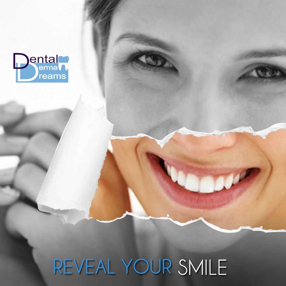 Dental Dreams | Aldoctorz